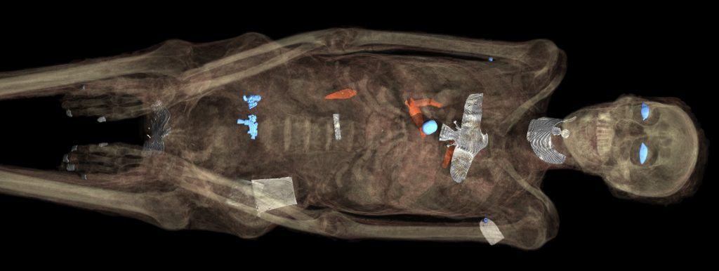 ‘Egyptian Mummies: Exploring Ancient Lives’ Reveals Secrets of Mummies ...