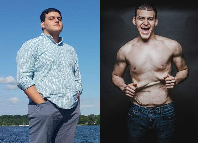 Young Egyptian Filmmaker’s Inspiring Struggle with Obesity and ...