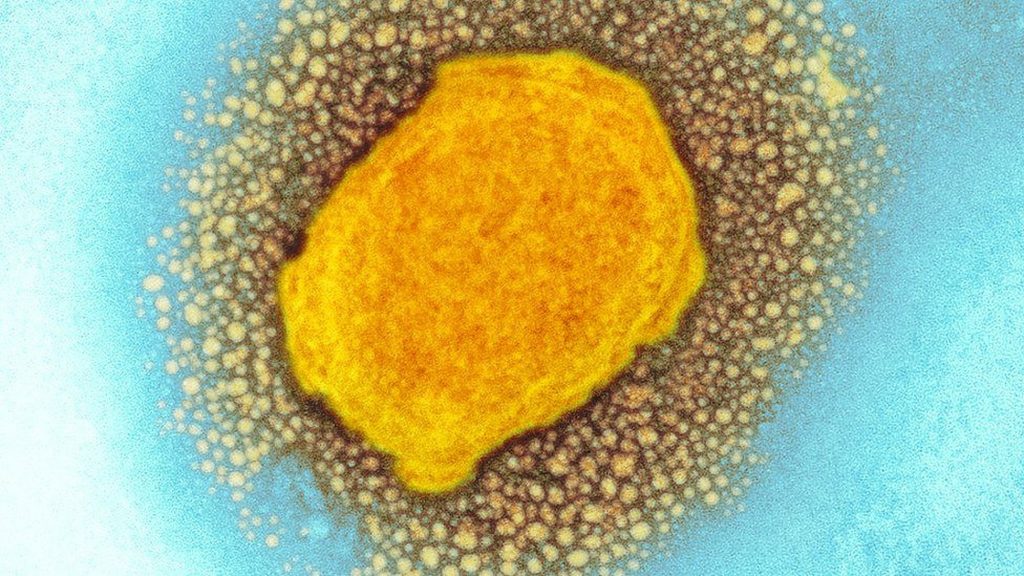 Egypt Reports First Case of Monkeypox | Egyptian Streets